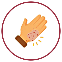 Known Irritants – SkinDrone