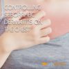 Controlling Seborrheic Dermatitis on the Chest – SkinDrone