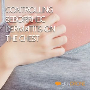 Controlling Seborrheic Dermatitis on the Chest – SkinDrone