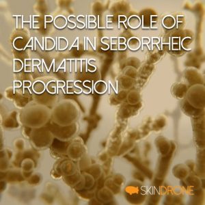The Possible Role of Candida in Seborrheic Dermatitis Progression ...