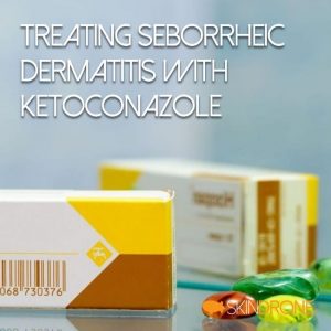 Ketoconazole for Treating Seborrheic Dermatitis: An In-Depth Research ...